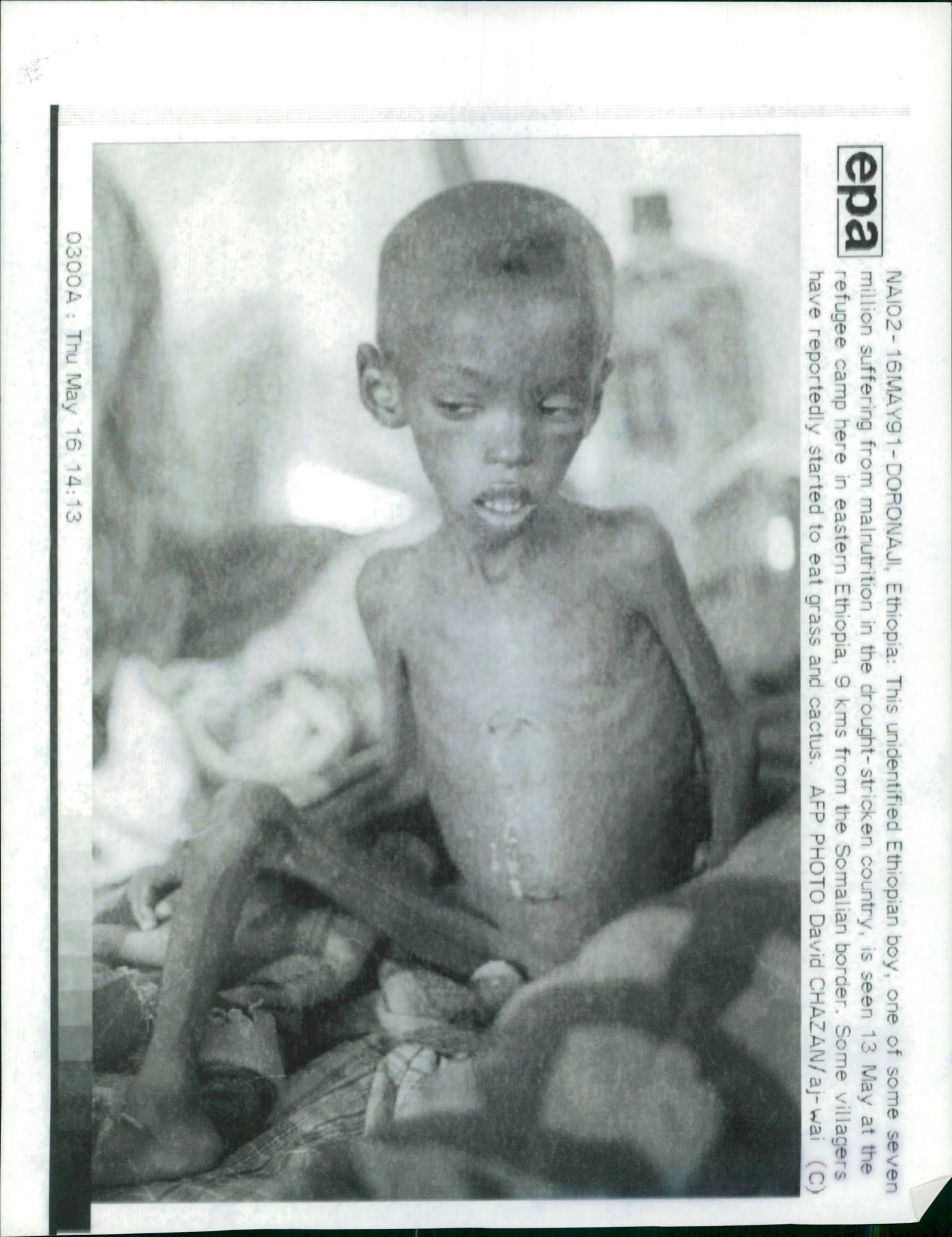 A famine affected malnourished Ethiopian boy - Vintage Photograph